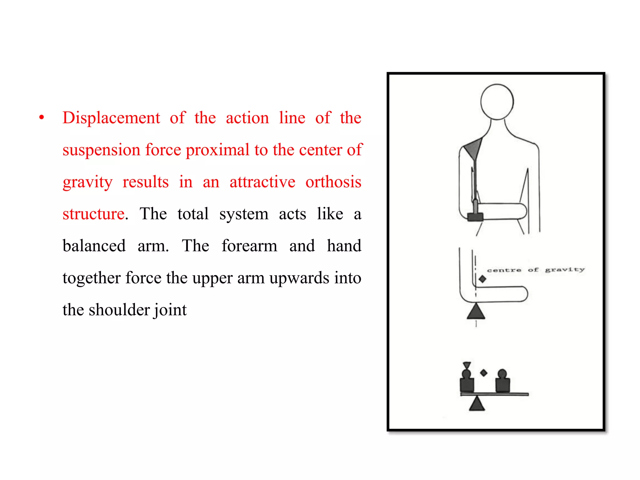 ADVANCED UPPER LIMB ORTHOTIC MANAGEMENT IN STROKE PPT.pptx