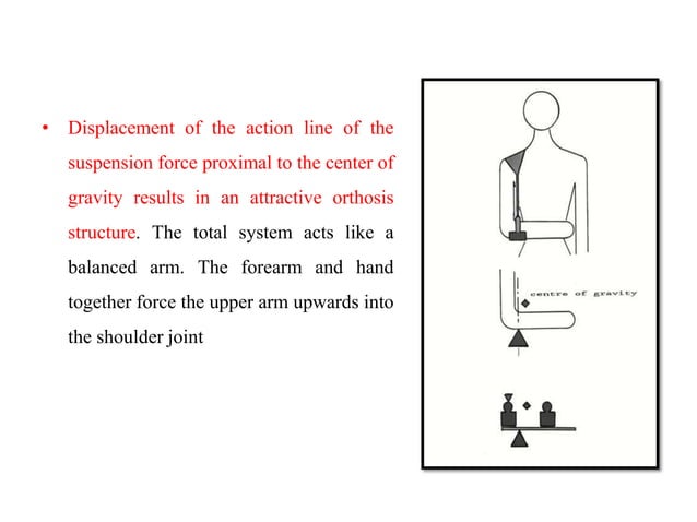 ADVANCED UPPER LIMB ORTHOTIC MANAGEMENT IN STROKE PPT.pptx | First Aid ...