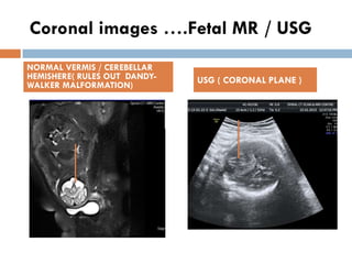 Advanced usg lounge | PPTX