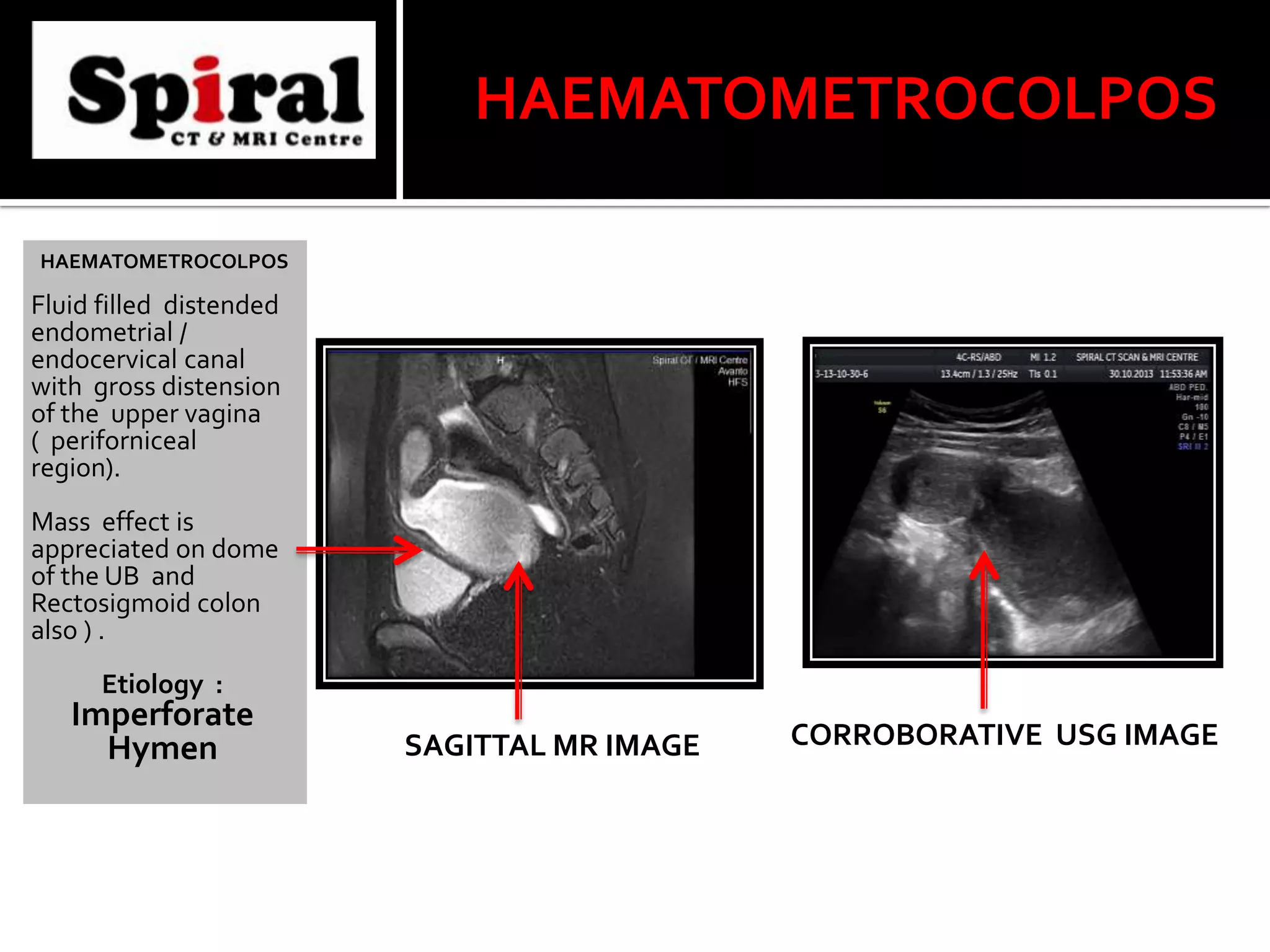 Advanced usg lounge gynaecology imaging series | PPTX