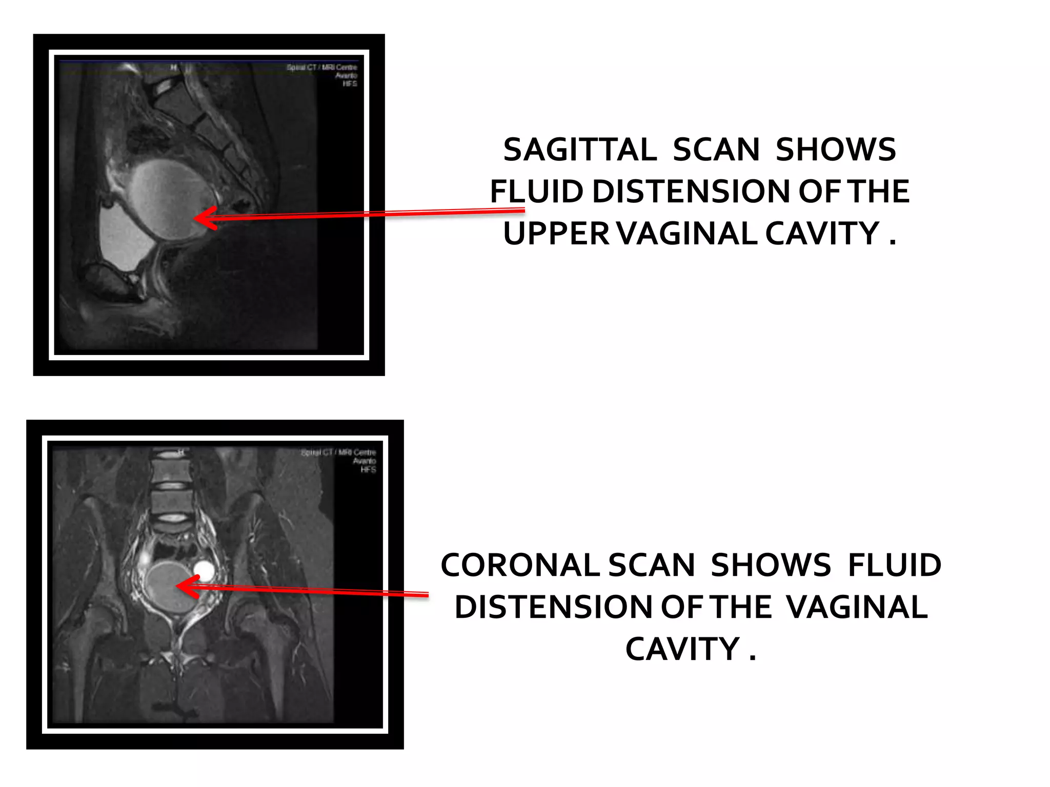 Advanced usg lounge gynaecology imaging series | PPTX