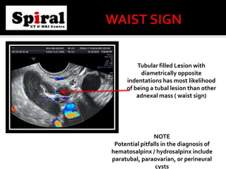 Advanced usg lounge gynaecology imaging series | PPTX | Pregnancy ...