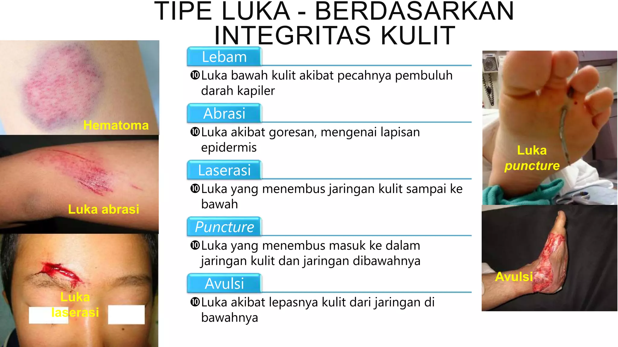 Advanced wound dressing..pptx