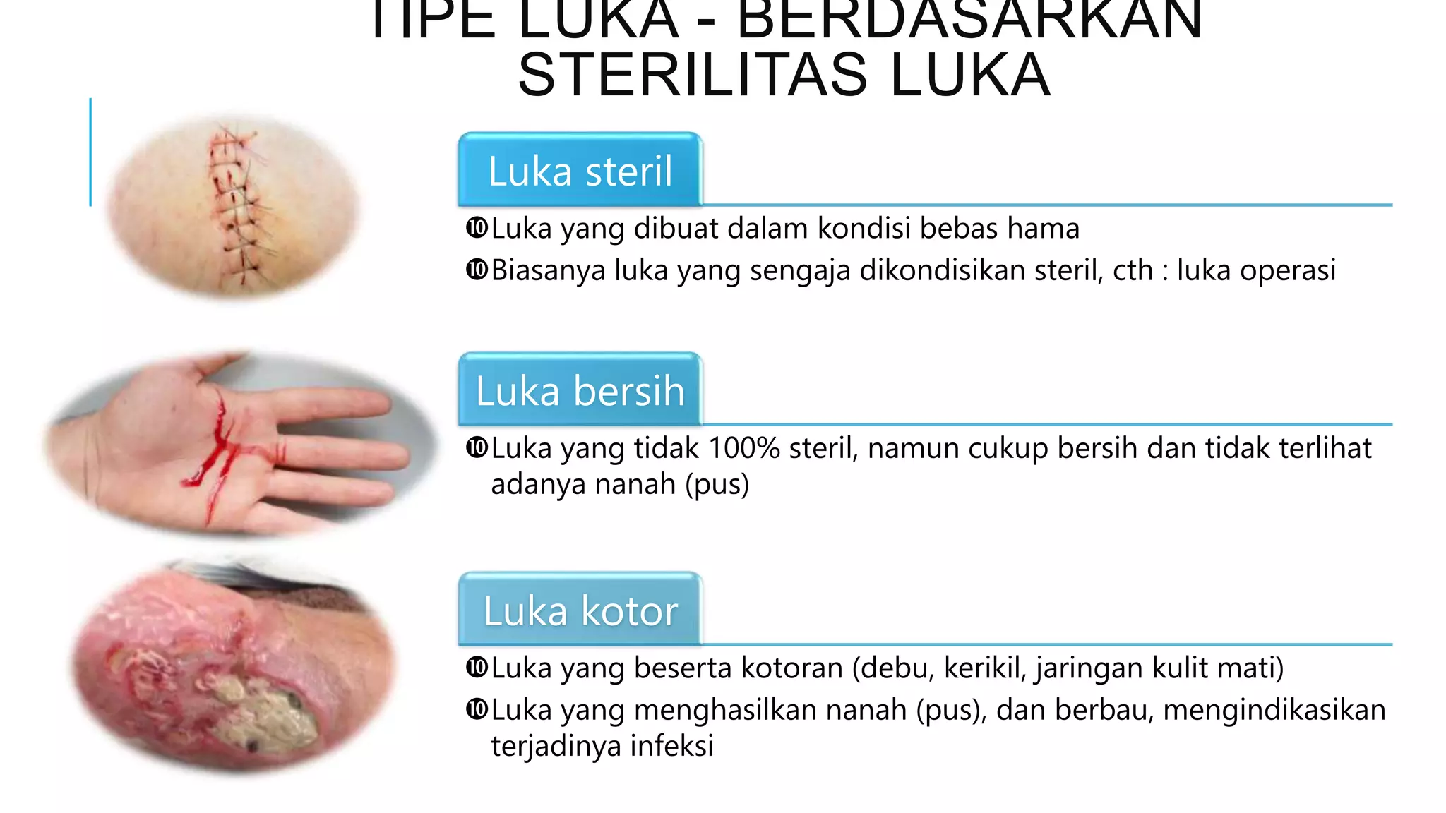 Advanced wound dressing..pptx