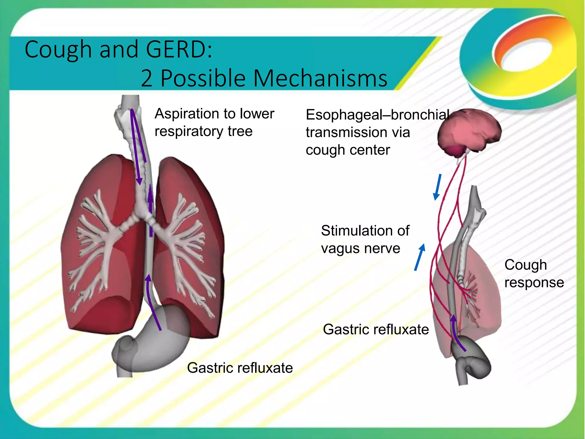 Advance Gerd Voniza Presenatation.pptx