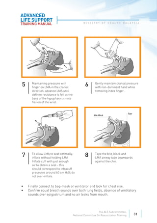 Advance Life Support 2022 PDF.pdf