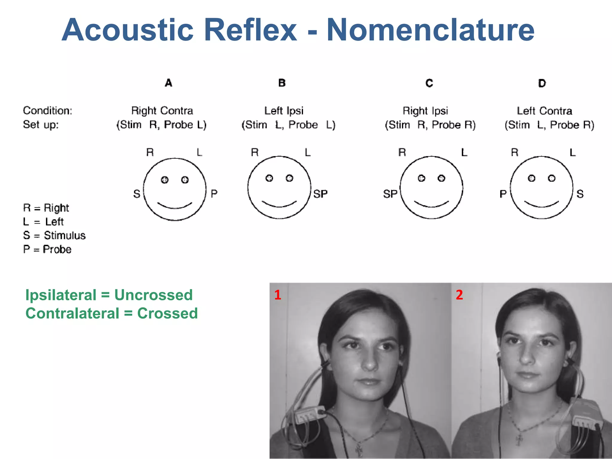 Advancement in acoustic reflex measures | PPTX