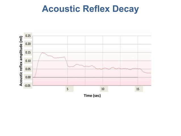 Advancement in acoustic reflex measures | PPTX