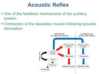 Advancement in acoustic reflex measures | PPT
