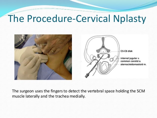 Advancement in back pain treatment