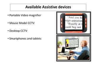 Advancement in Low Vision management.pptx