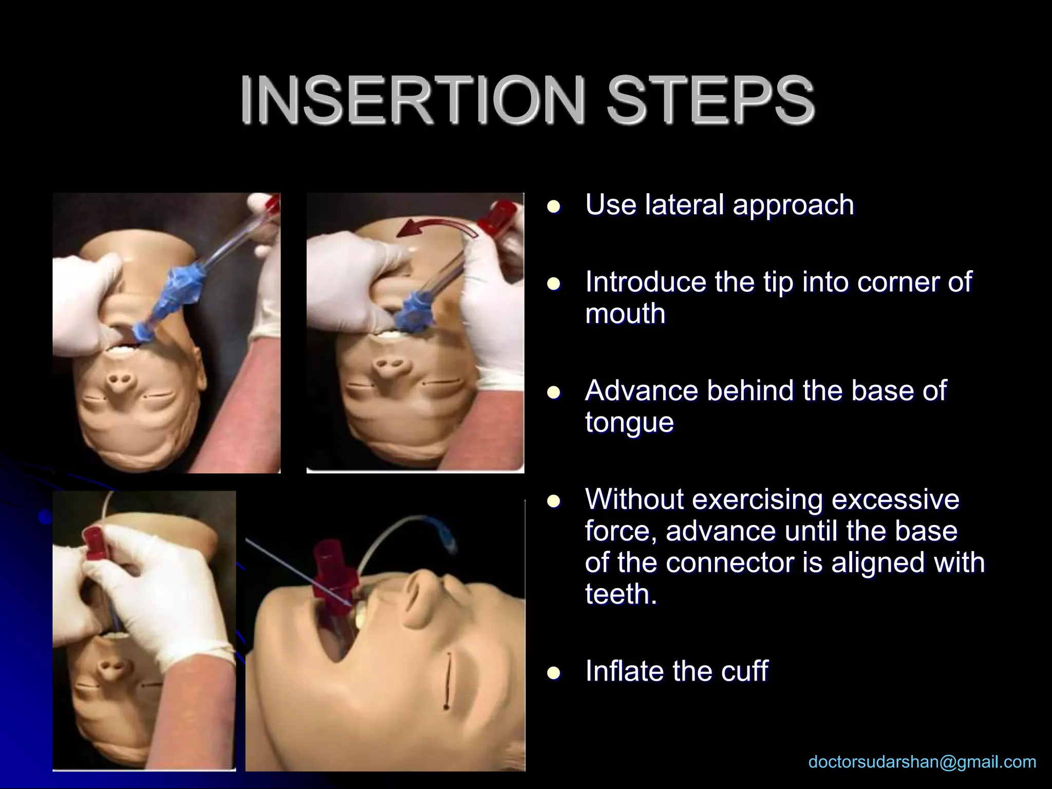 Advancement in Supra-glottic Airways.ppt