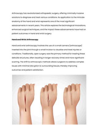 Advancements in Arthroscopic Techniques for Hand and Wrist Surgery.pdf