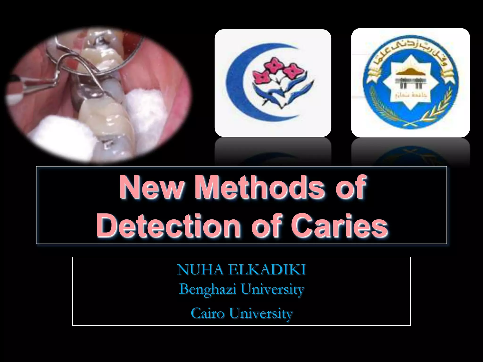 Advance Method In Detection Of Dental Caries Copy Ppt