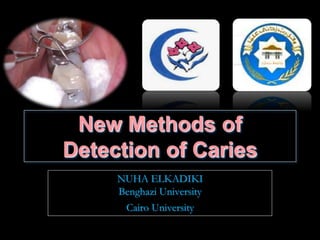 Advance method in detection of dental caries copy | PPT