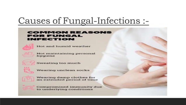 ANTI FUNGAL AGENTS AND THEIR MECHANISM OF ACTION. | PPT