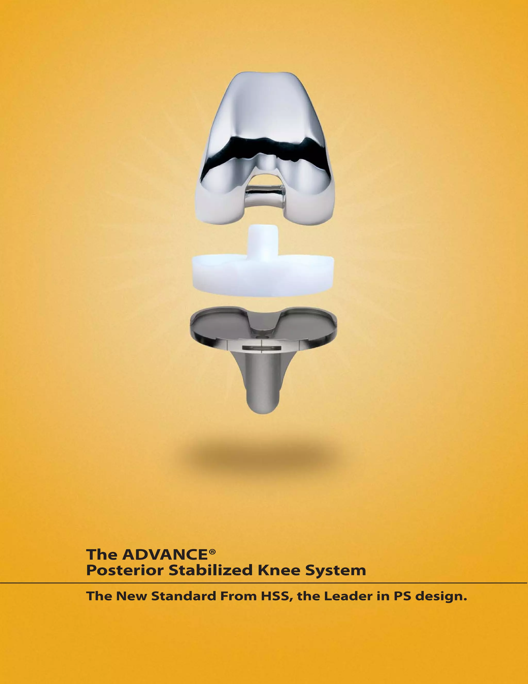 Advance® posterior stabilized knee system | PDF