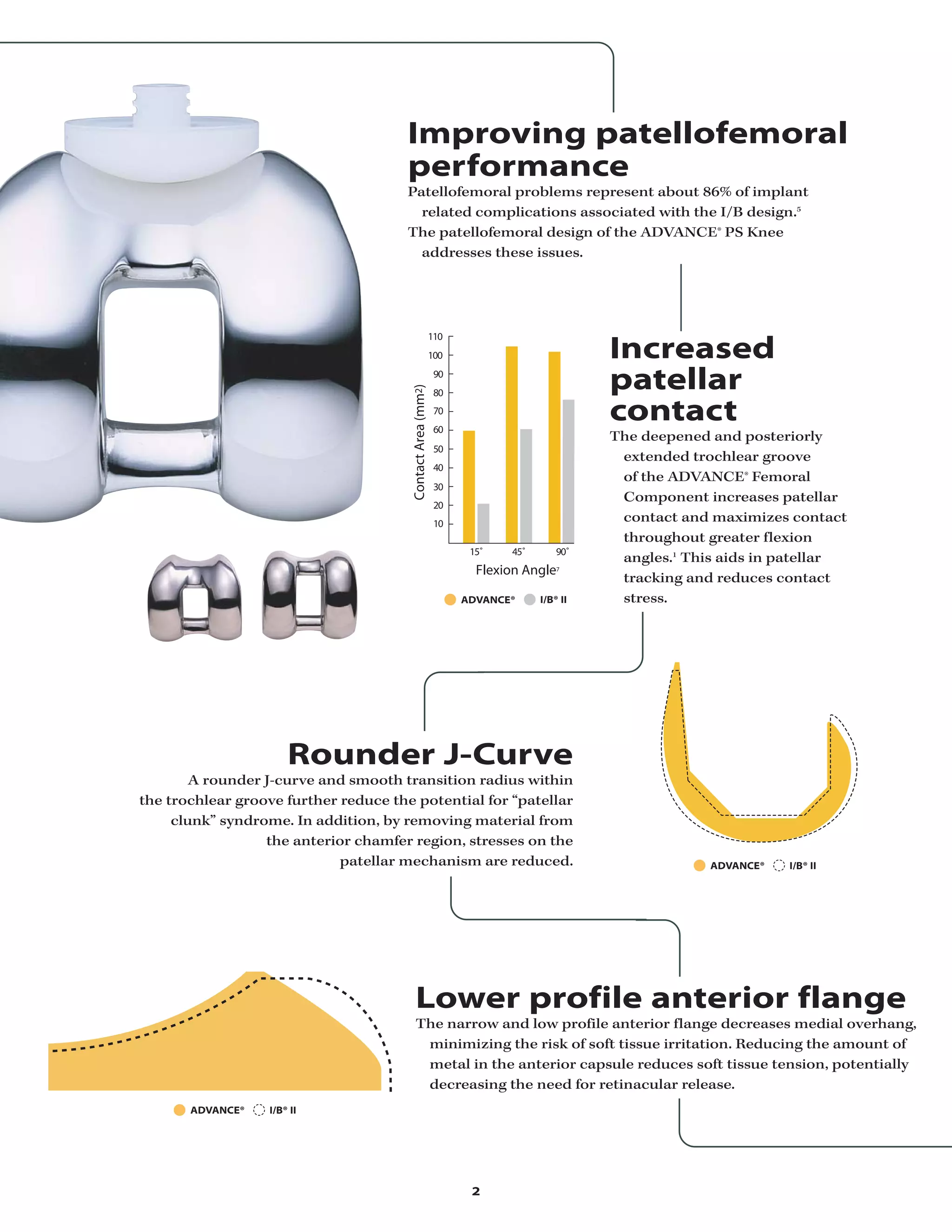 Advance® posterior stabilized knee system | PDF