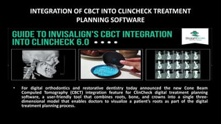 ADVANCES IN ALIGNER TREATMENT | PPTX