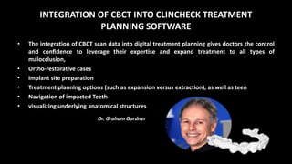 ADVANCES IN ALIGNER TREATMENT | PPTX