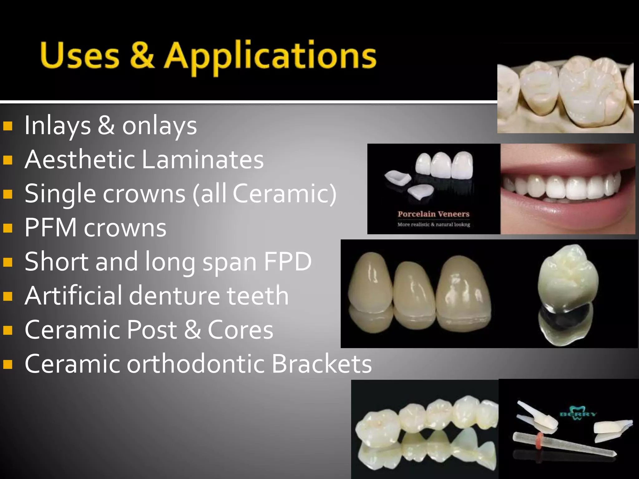 Recent Advances in Dental Ceramics | PPTX