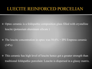 Recent Advances in Dental Ceramics | PPTX
