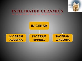 Recent Advances in Dental Ceramics | PPTX