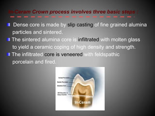Recent Advances in Dental Ceramics | PPTX