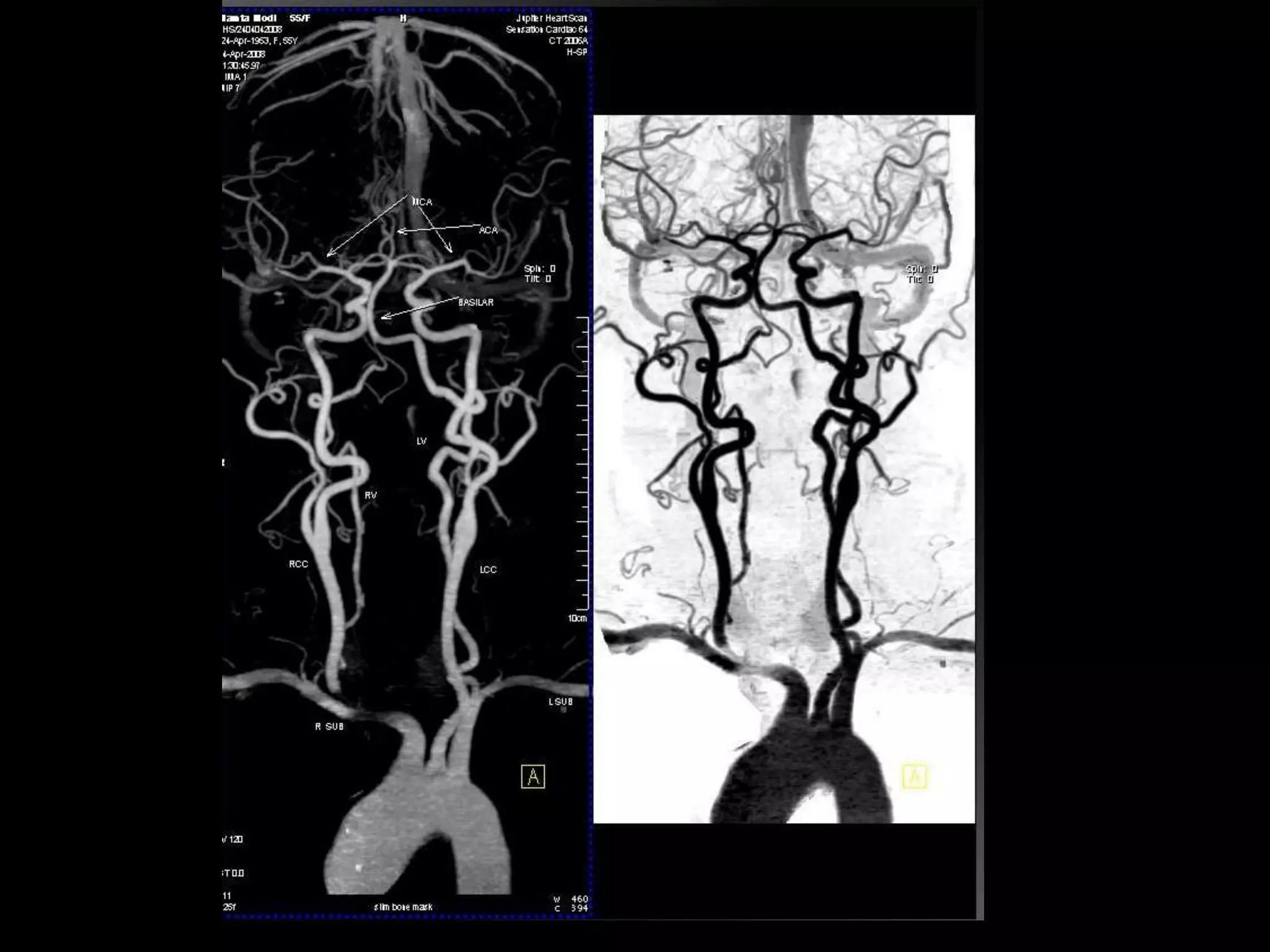 Advances in ct technology | PPTX