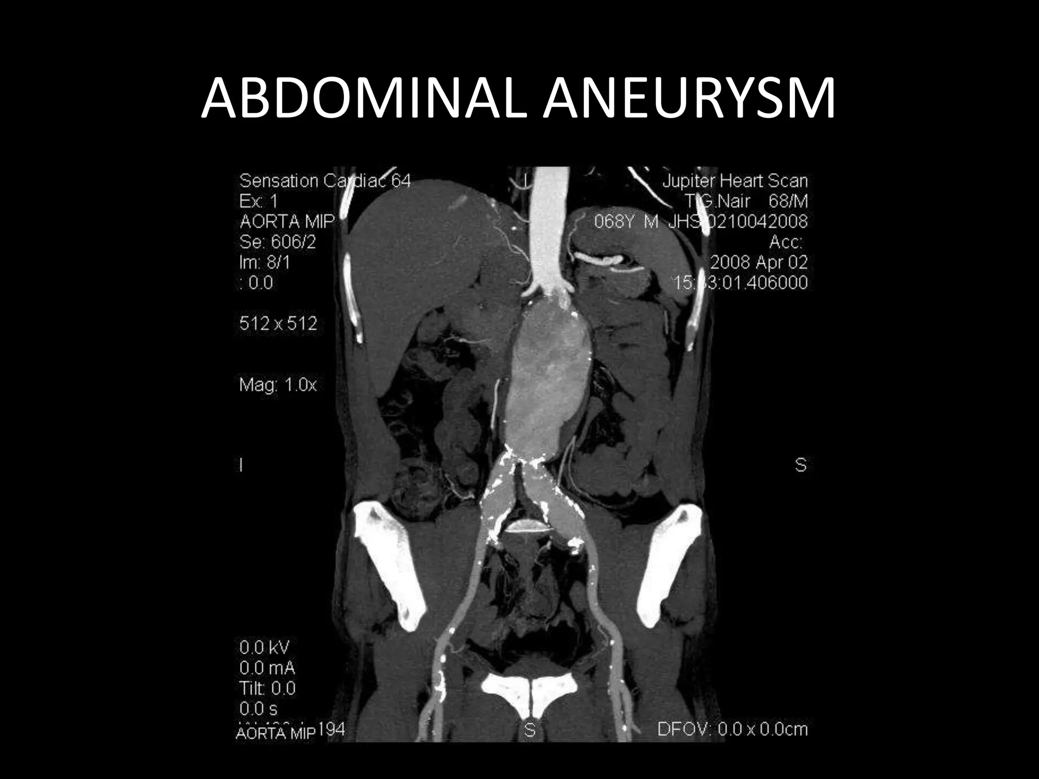 Advances in ct technology | PPTX