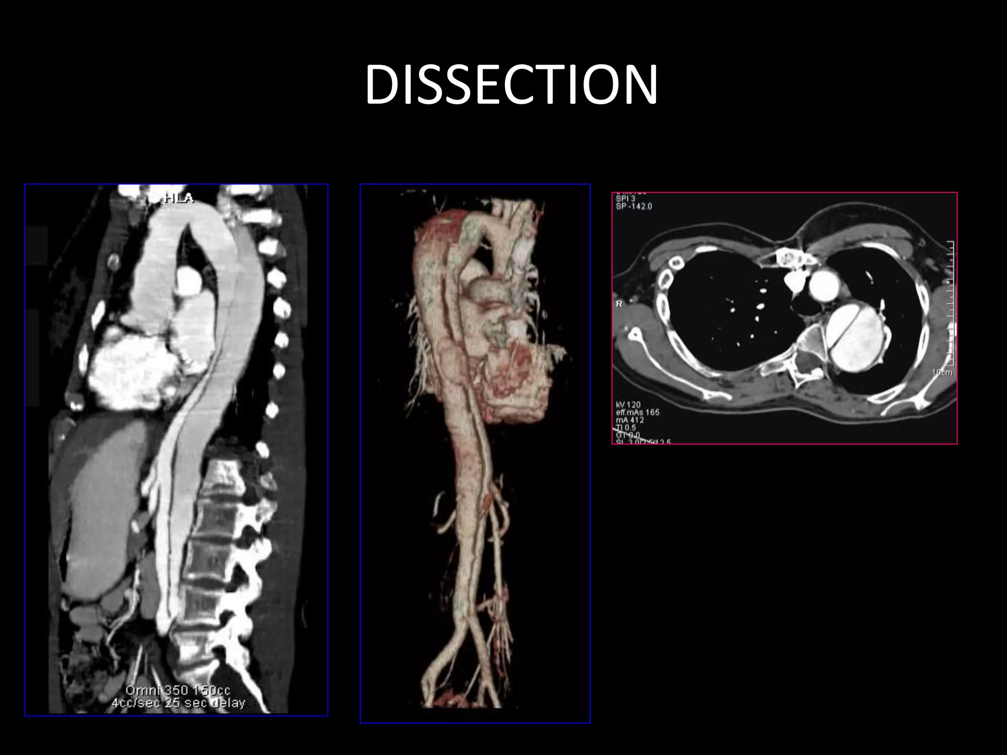 Advances in ct technology | PPTX