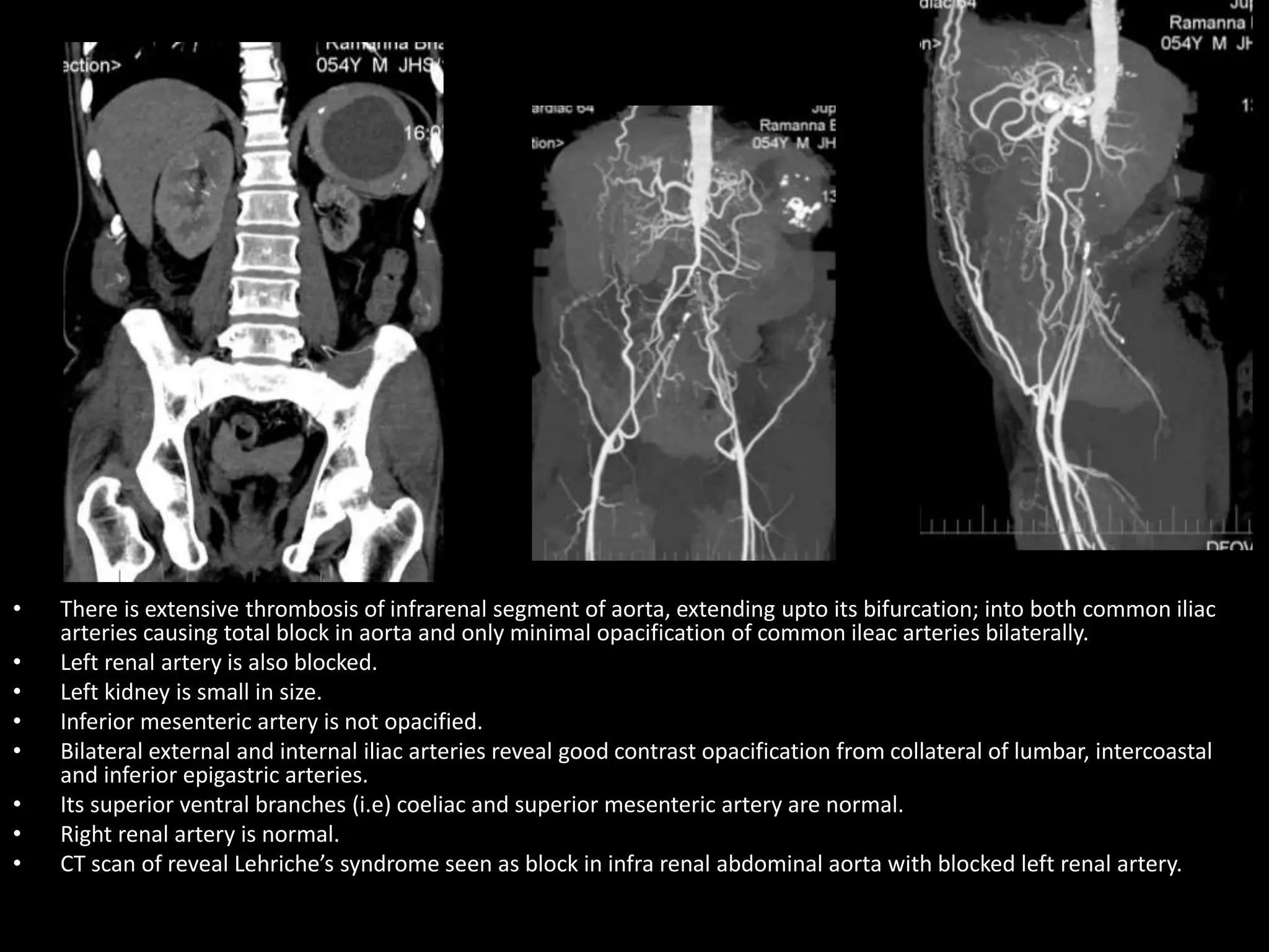 Advances in ct technology | PPTX