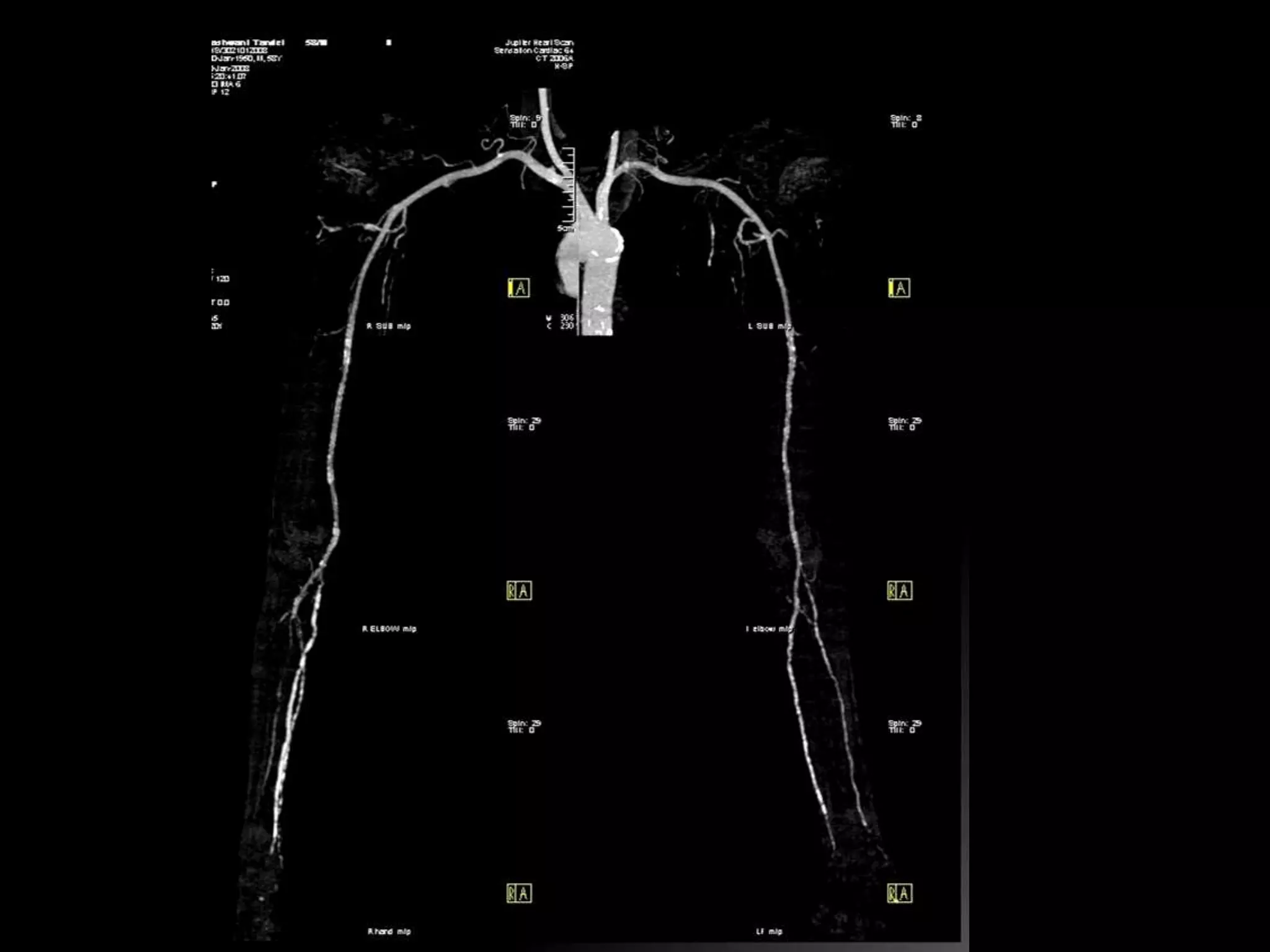 Advances in ct technology | PPTX