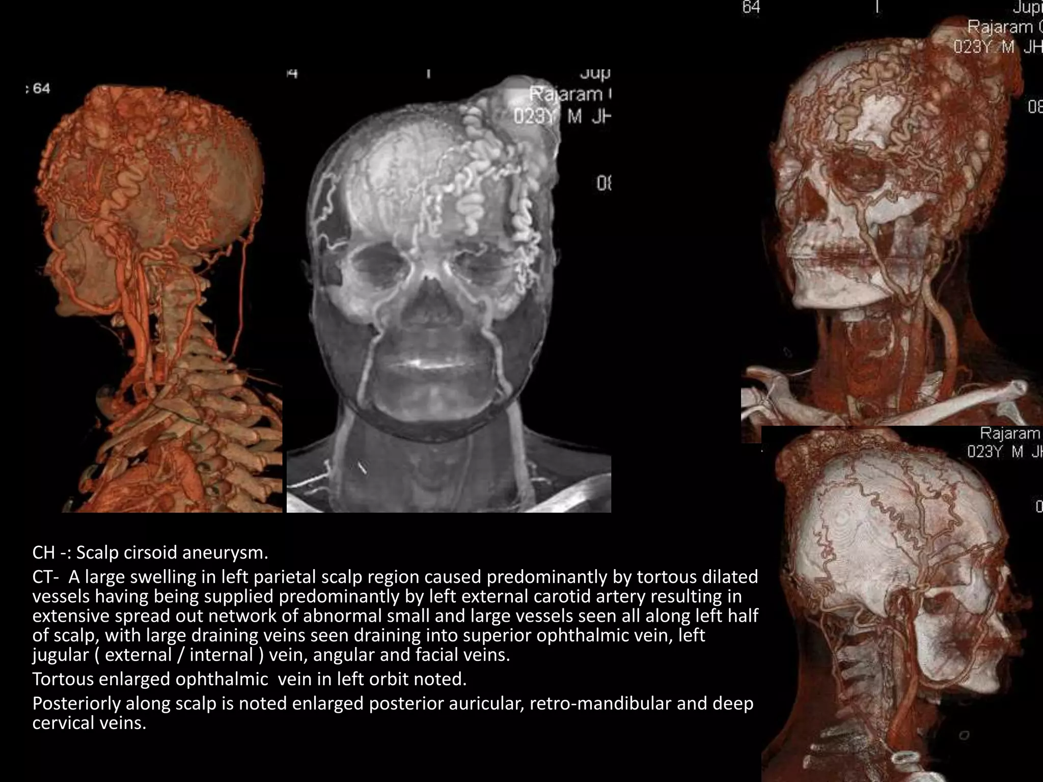 Advances in ct technology | PPTX