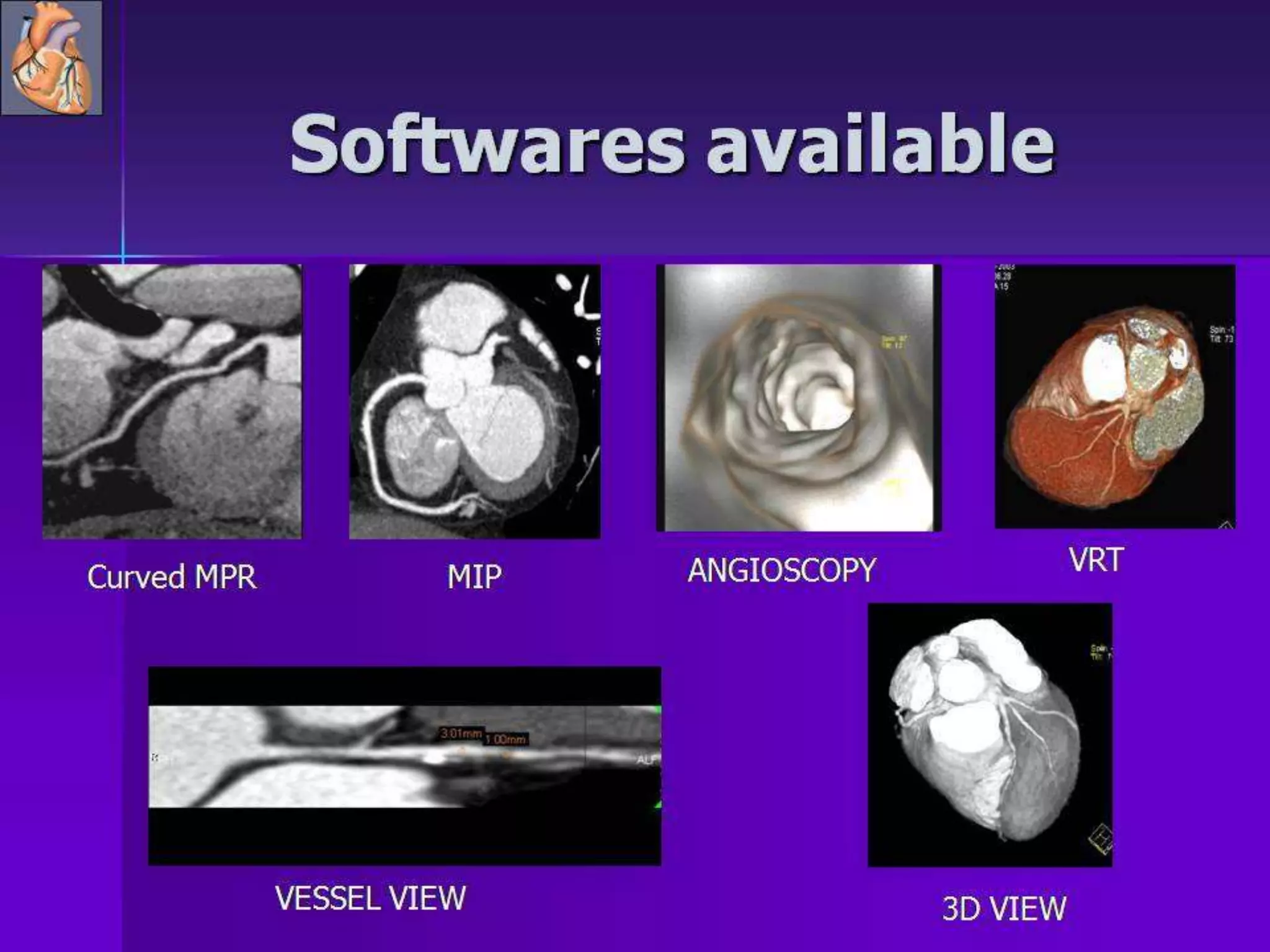Advances in ct technology | PPTX