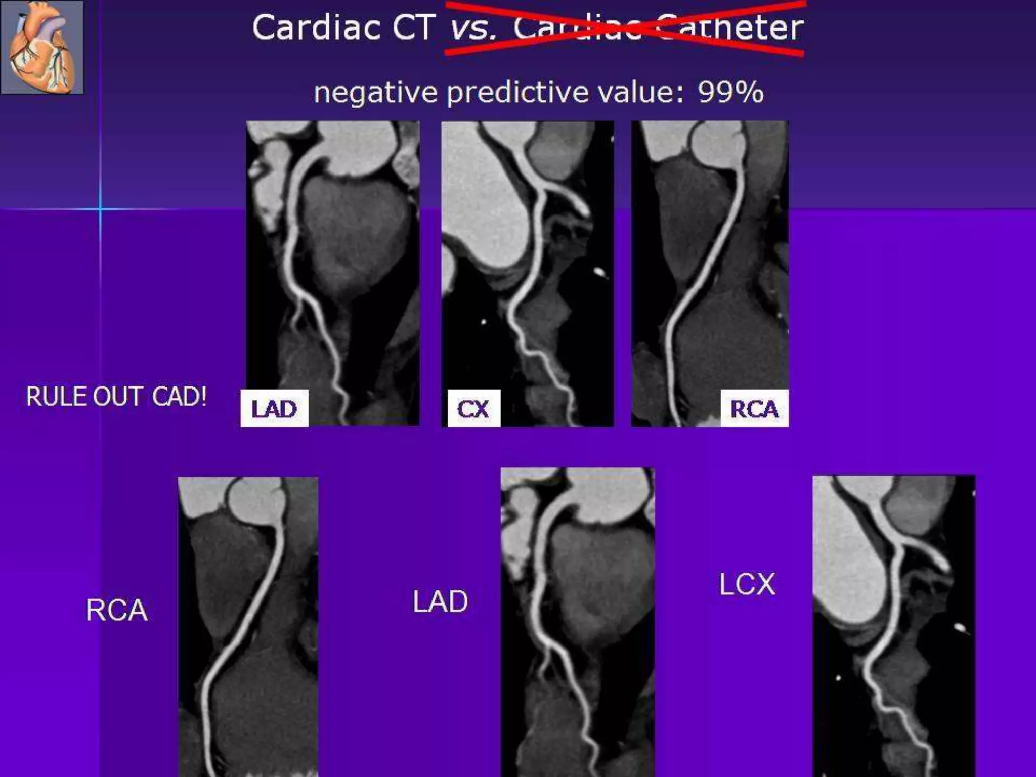 Advances in ct technology | PPTX