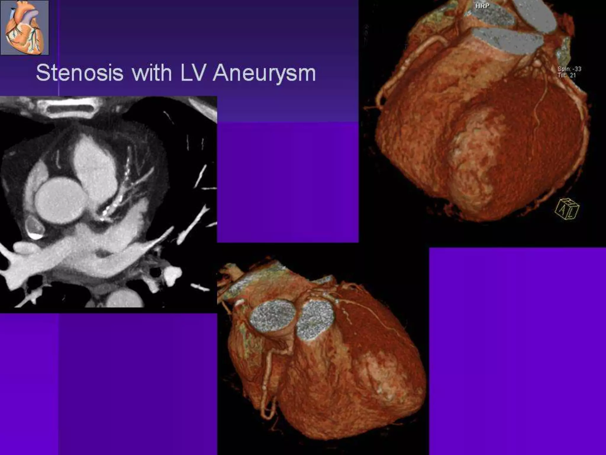 Advances in ct technology | PPTX
