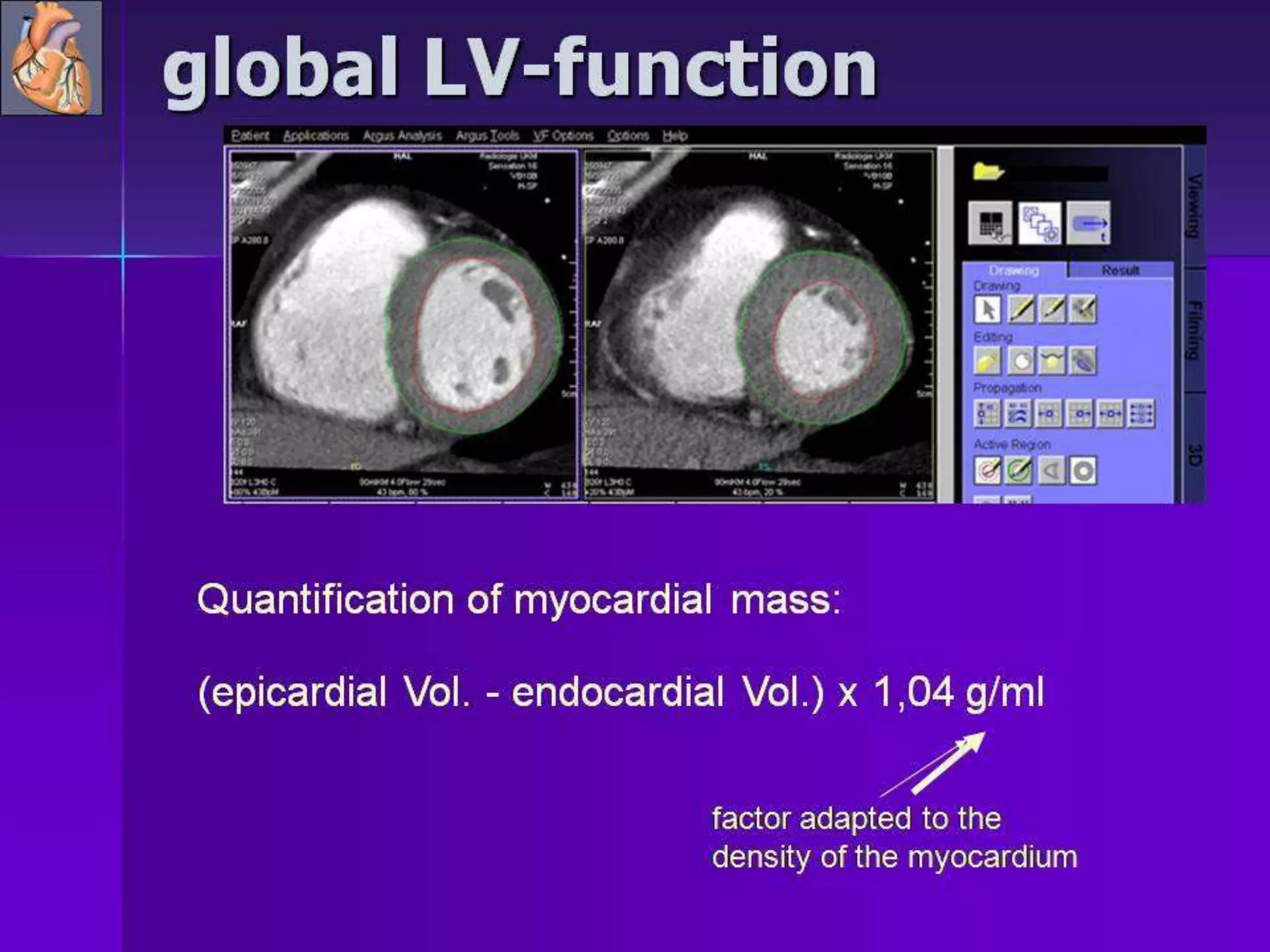 Advances in ct technology | PPTX