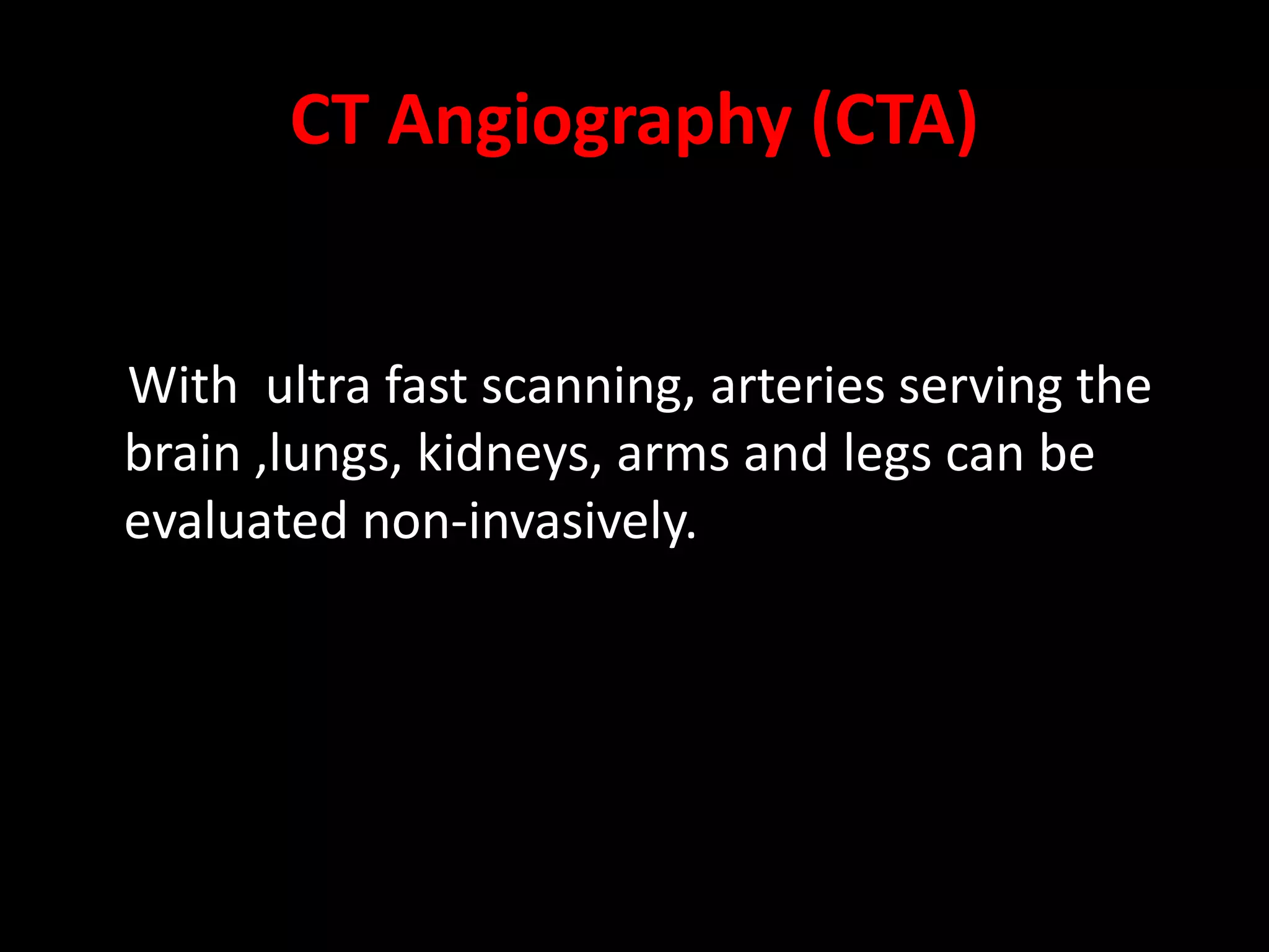 Advances in ct technology | PPTX