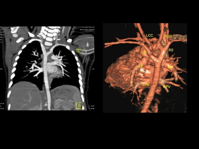 Advances in ct technology | PPTX | Medical Tests | Medical Health
