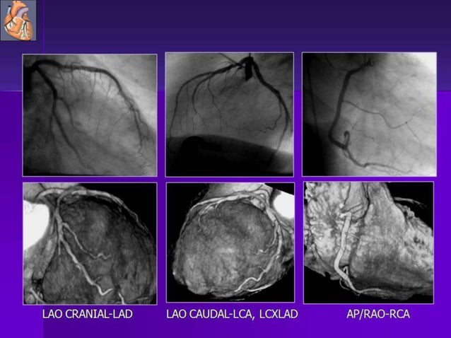 Advances in ct technology | PPTX | Medical Tests | Medical Health
