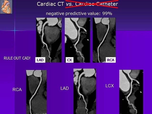 Advances in ct technology | PPTX | Medical Tests | Medical Health