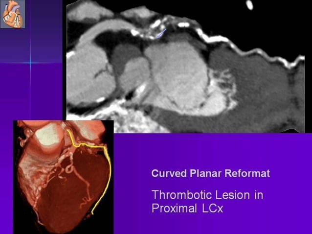 Advances in ct technology | PPTX | Medical Tests | Medical Health