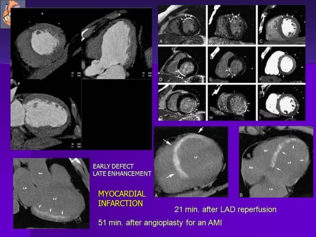 Advances in ct technology | PPTX | Medical Tests | Medical Health