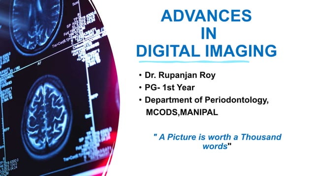 Advances in digital imaging | PPTX | Dental Health | Diseases and ...