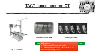 Advances in digital imaging | PPTX