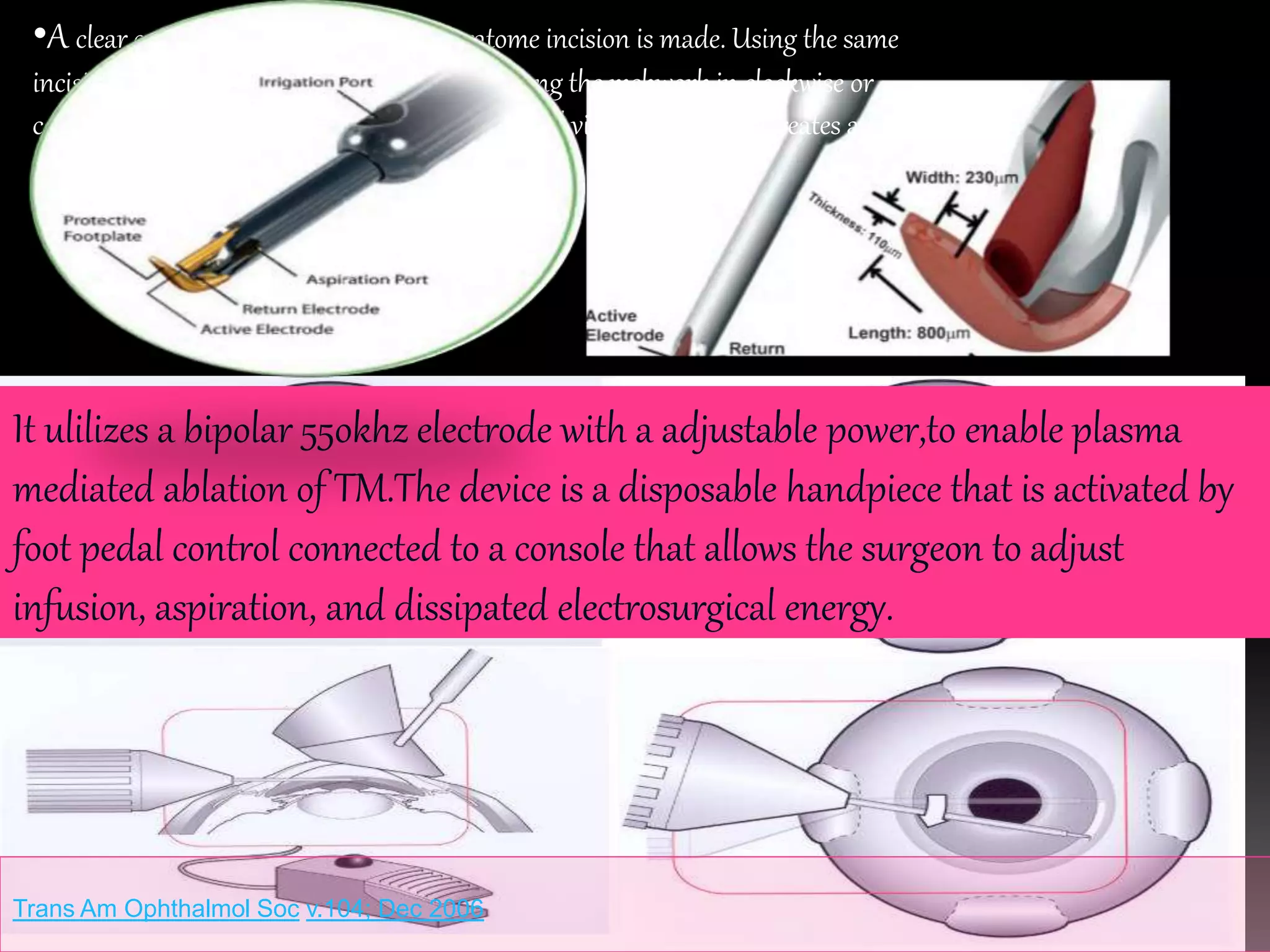 Advances in glaucoma surgeries | PPTX