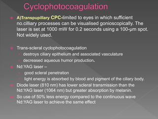 Advances in glaucoma surgeries | PPT