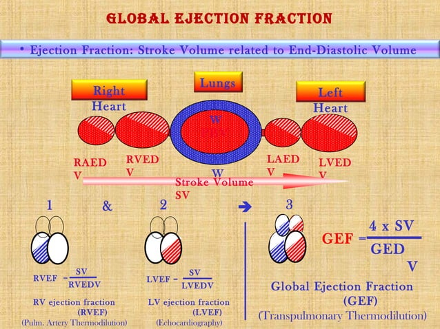 Advances in haemodynamic monitoring | PPT
