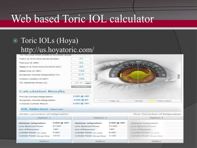 Advances in iol calculation